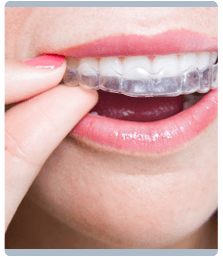 Invisalign Columbus OH | The Dental Center at Easton Town Center